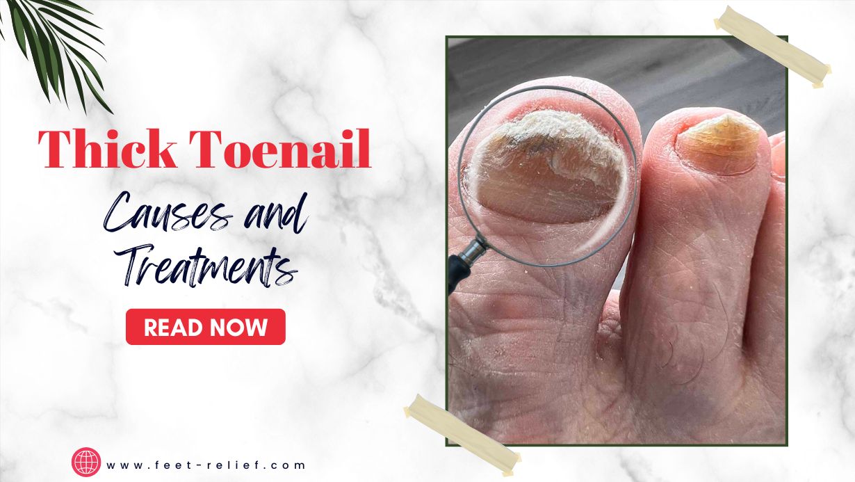 Thick Toenail Care At William Emery Blog Thick Toenail Care At William Emery Blog