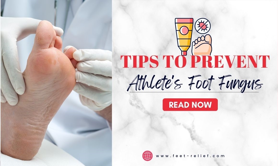 Tips to Prevent Athlete's Foot Fungus - Feet Relief
