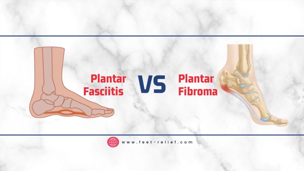 Plantar Fasciitis vs Plantar Fibroma - Feet Relief