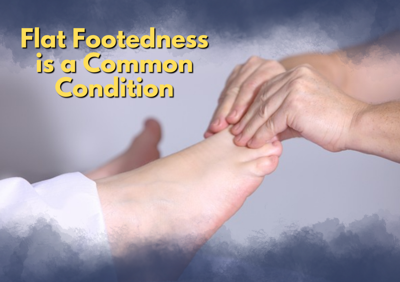 Managing Knee Pain From Flat Feet - Feet Relief