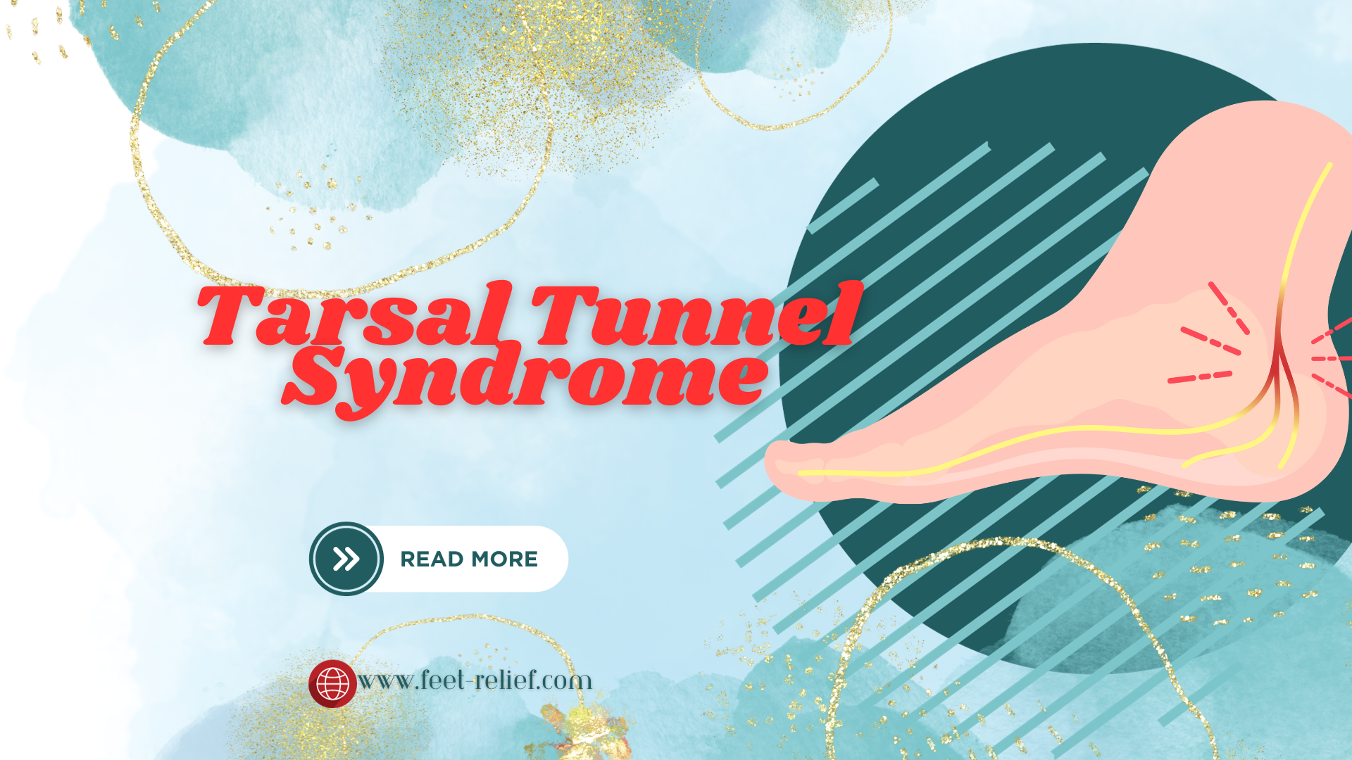 Tarsal Tunnel Syndrome, Prevention and Treatment - Feet Relief